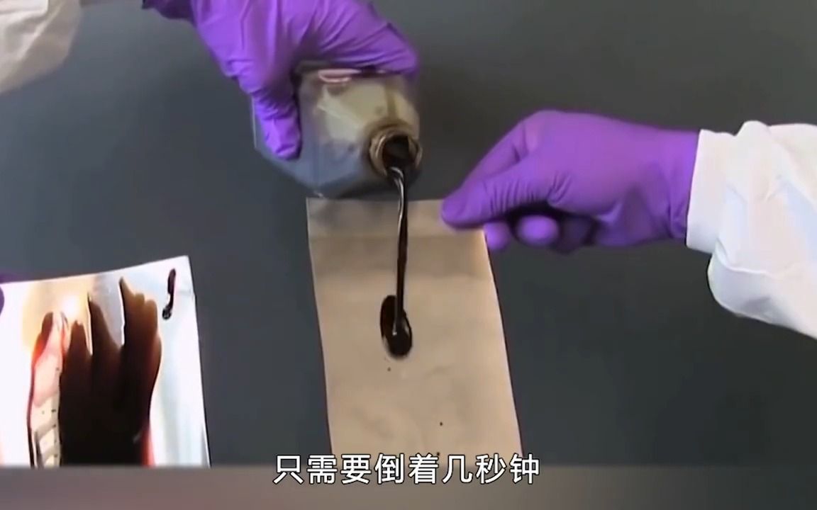 皮肤拉链器能替代创口贴和缝针手术5个最方便的生活新发明