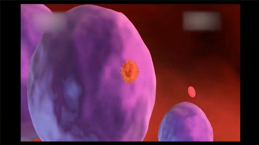 最世界上最可怕的病毒之一,艾滋病的起源。让我们一探究竟