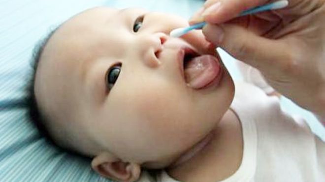 小孩鼻塞怎么办教你7个办法,1分钟马上通气!