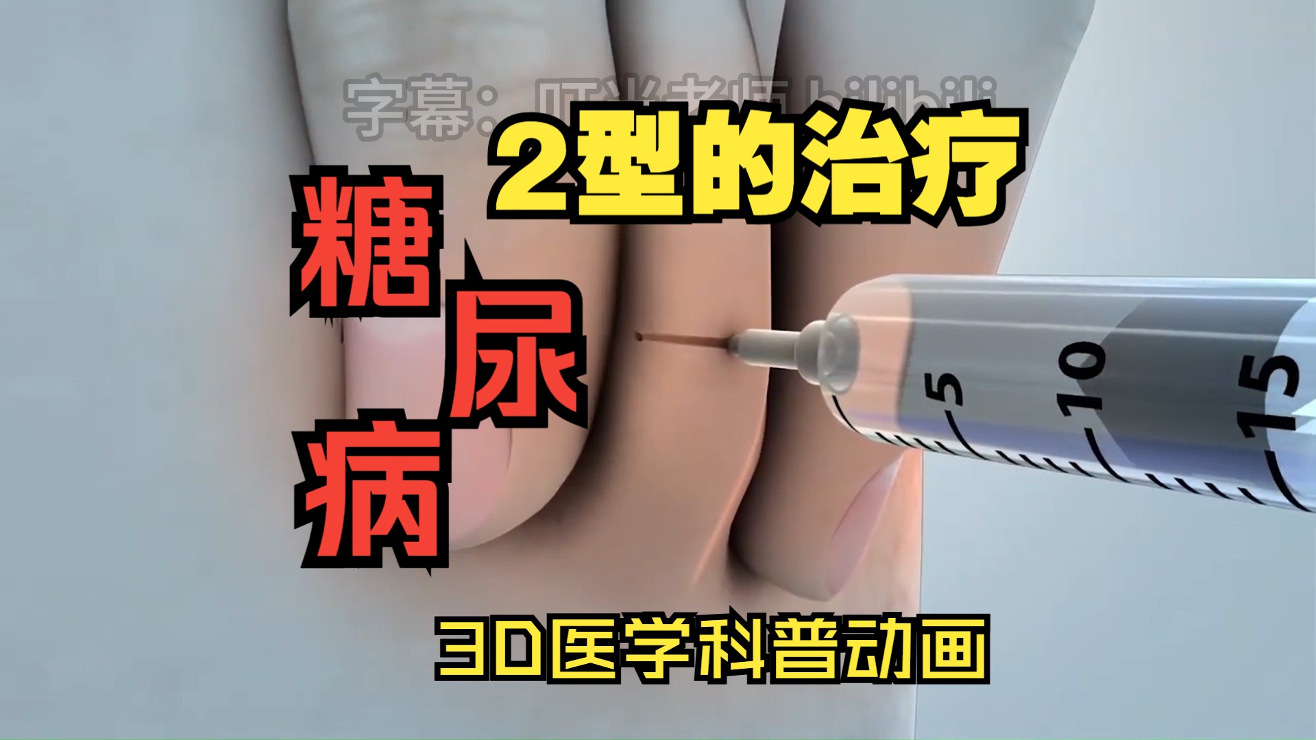 2型糖尿病该如何治疗?不同种类药物对比及生活习惯 3D科普动画(...