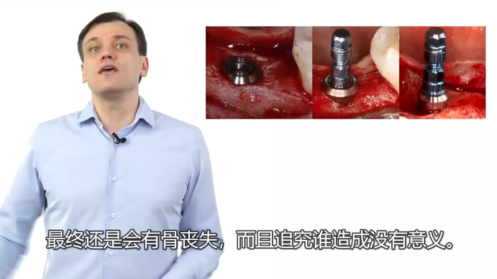 零骨丧失,根据不同设计放置种植体