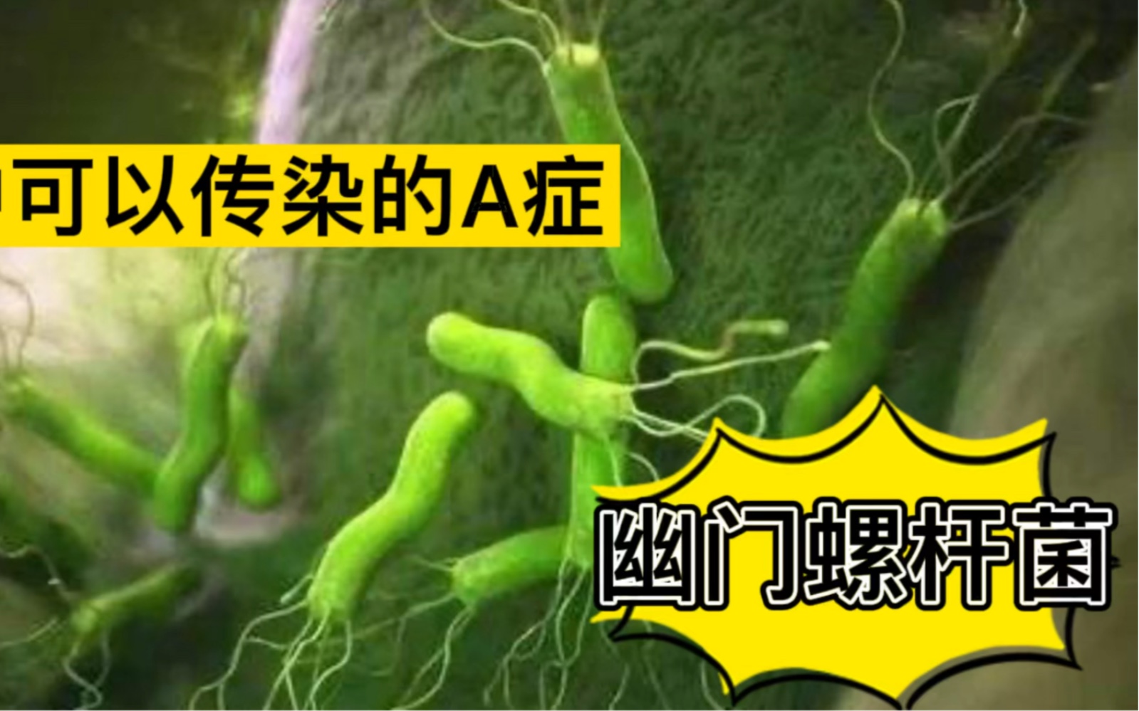 一种可以传染的A症～幽门螺旋杆菌(HP)