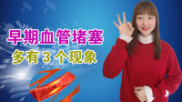 血管堵塞一般都有哪些症状?医生:血管出现瘀堵,前期有3个现象