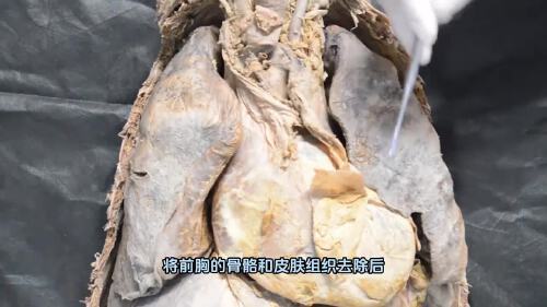 将前胸的骨骼和皮肤组织去除后,胸腔内的器官结构就会出现在你的眼前