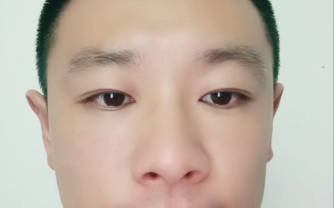 如何合理使用抗生素?