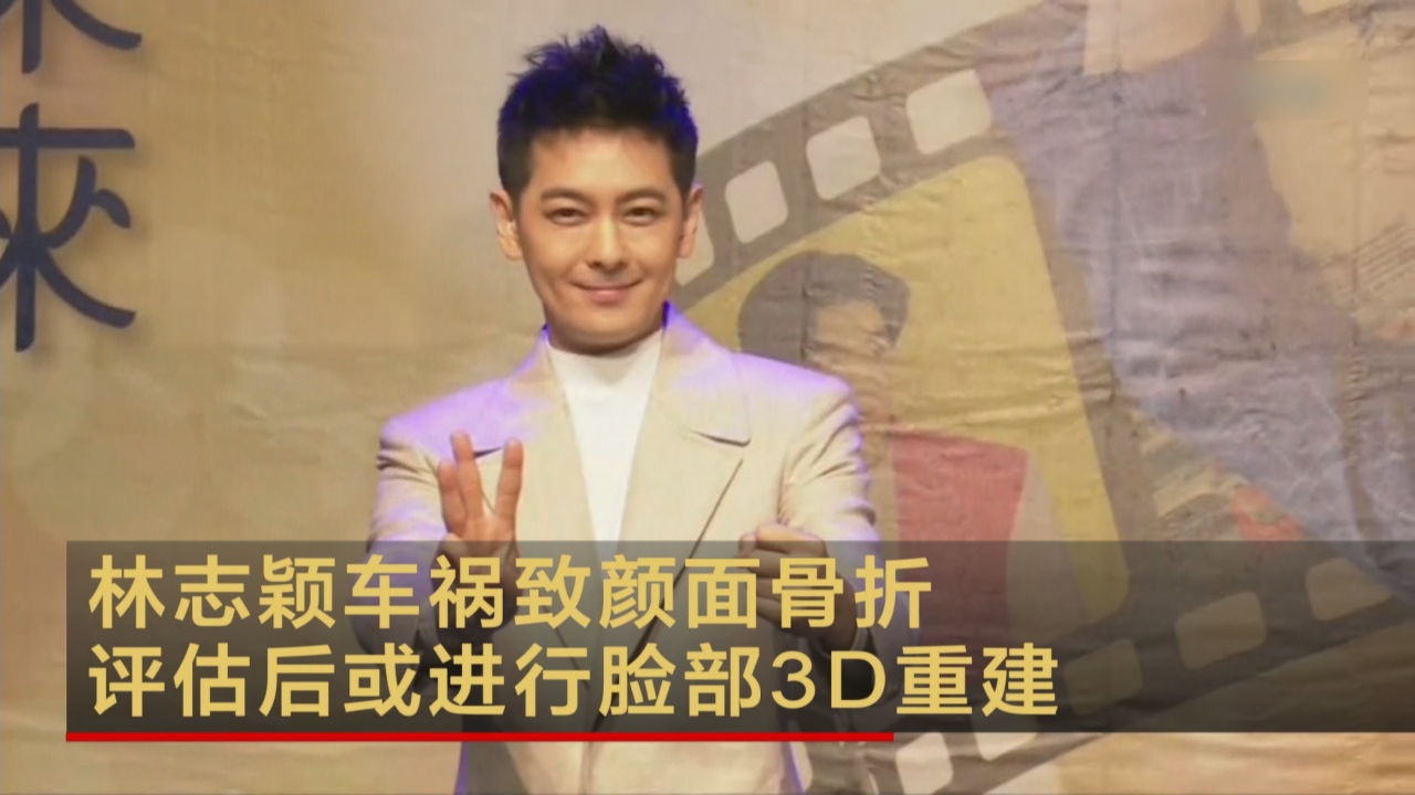 林志颖车祸致颜面骨折 评估后或进行脸部3D重建