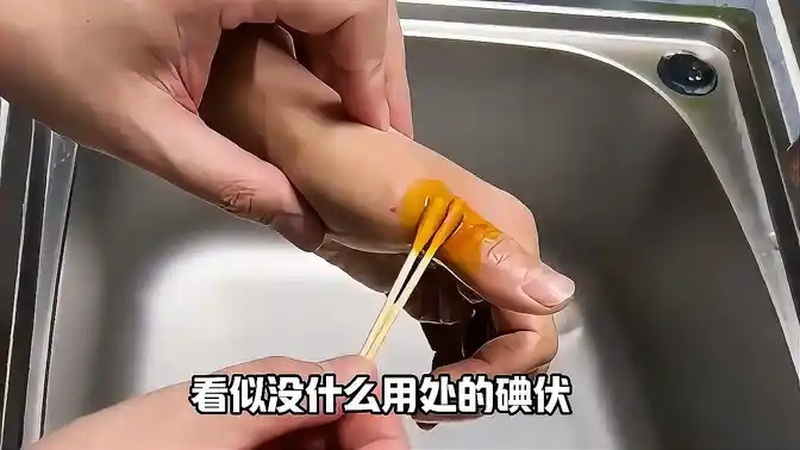没想到看似没有用的碘伏,用处竟然这么大简直太离谱了!