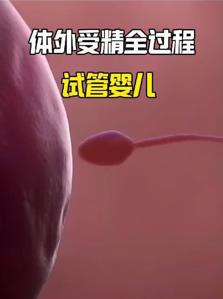 体外受精全过程,试管婴儿是如何产生的 体外受精
