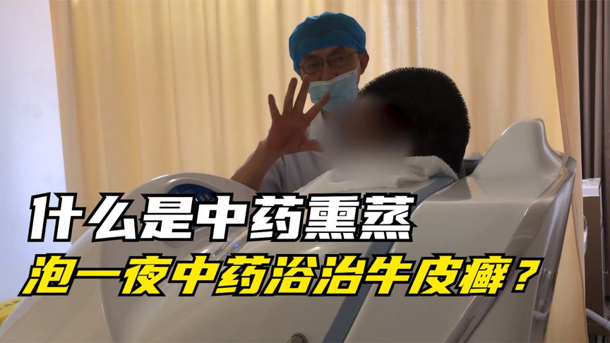 【泡一夜中药浴?】男子牛皮癣瘙痒难耐:医生带你走进中药熏蒸