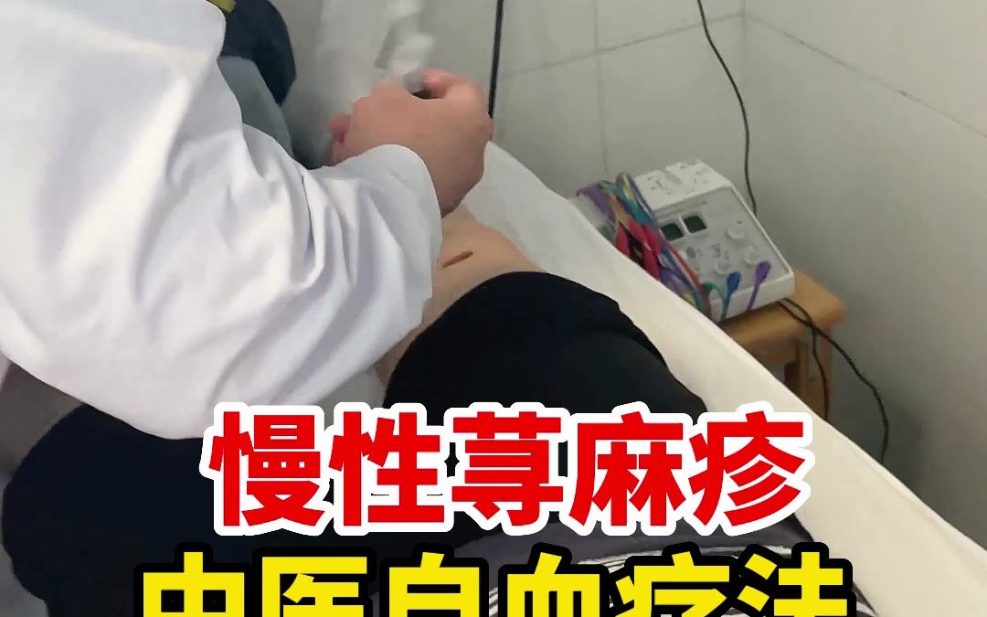 慢性荨麻疹中医自血疗法