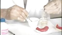 口腔修复常用取印模技术