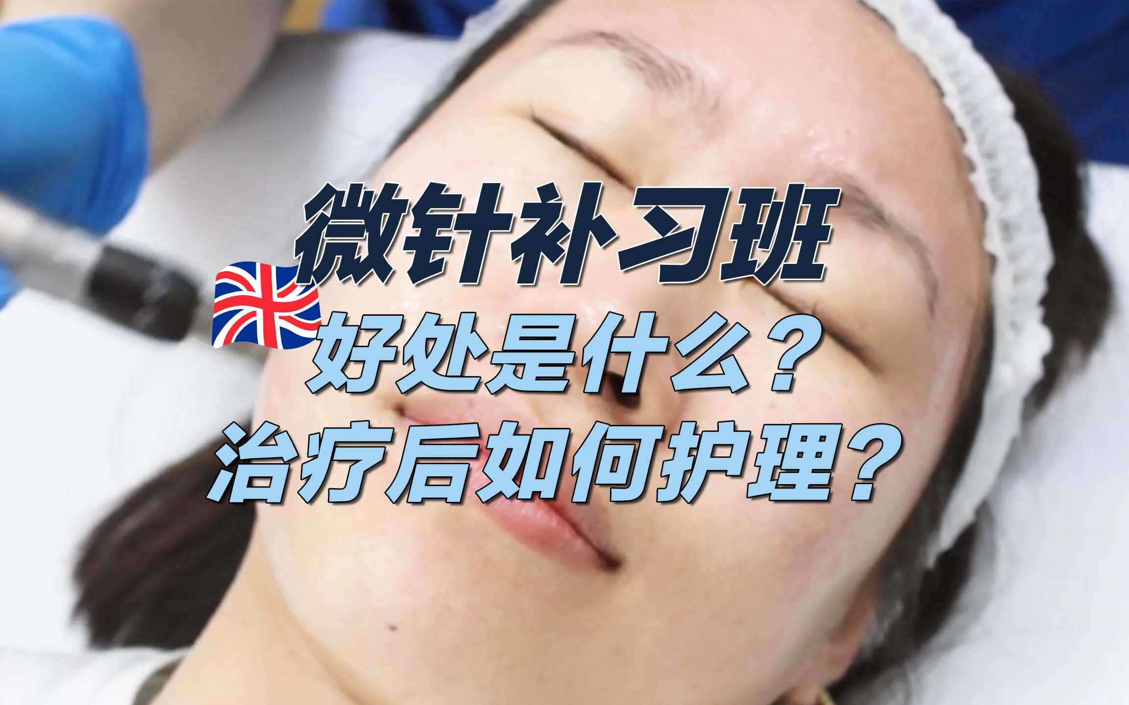 微针是什么?注意事项?