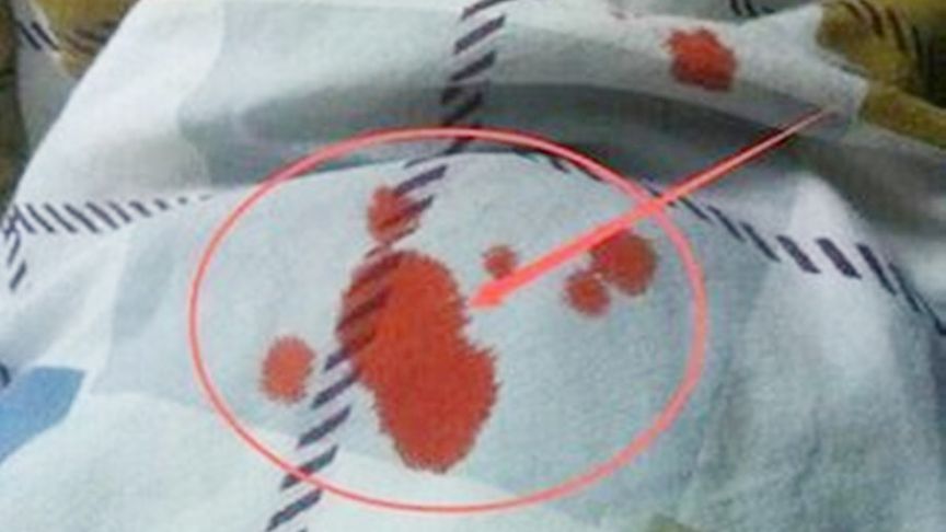 棉被上染上血渍很难清洗?教你四招,轻松祛除无痕迹