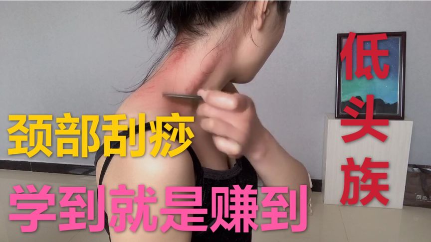 颈部刮痧实操教程,简便易行,缓解肩颈不适