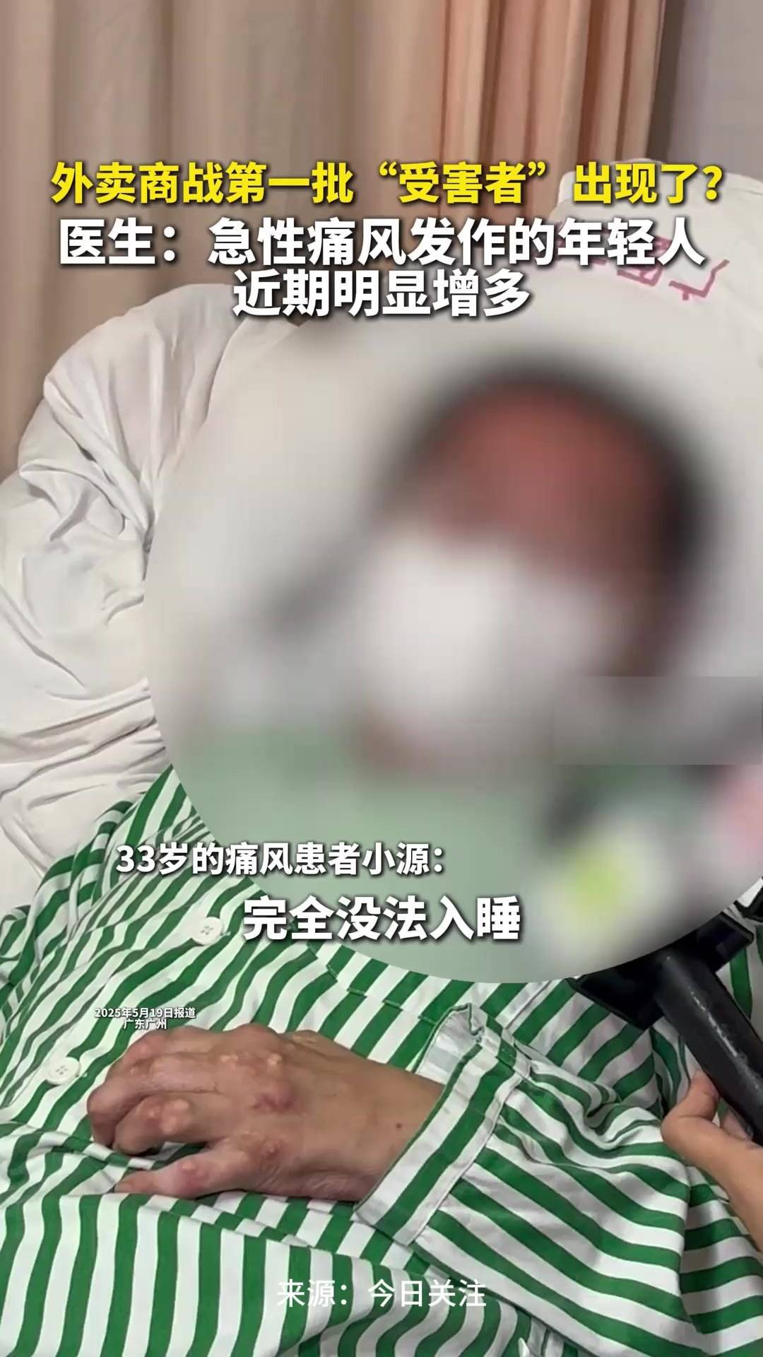 外卖商战第一批“受害者”出现了?医生:急性痛风发作的年轻人近期...