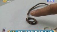 输尿管支架滞留体内7年 121019 么敢当