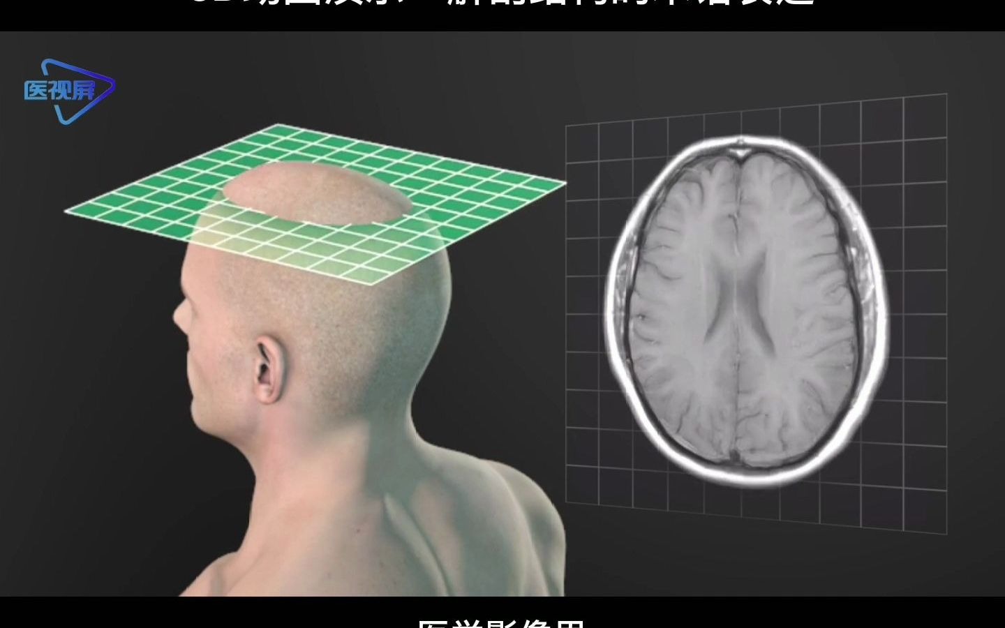 3D动画演示:解剖结构的术语表述