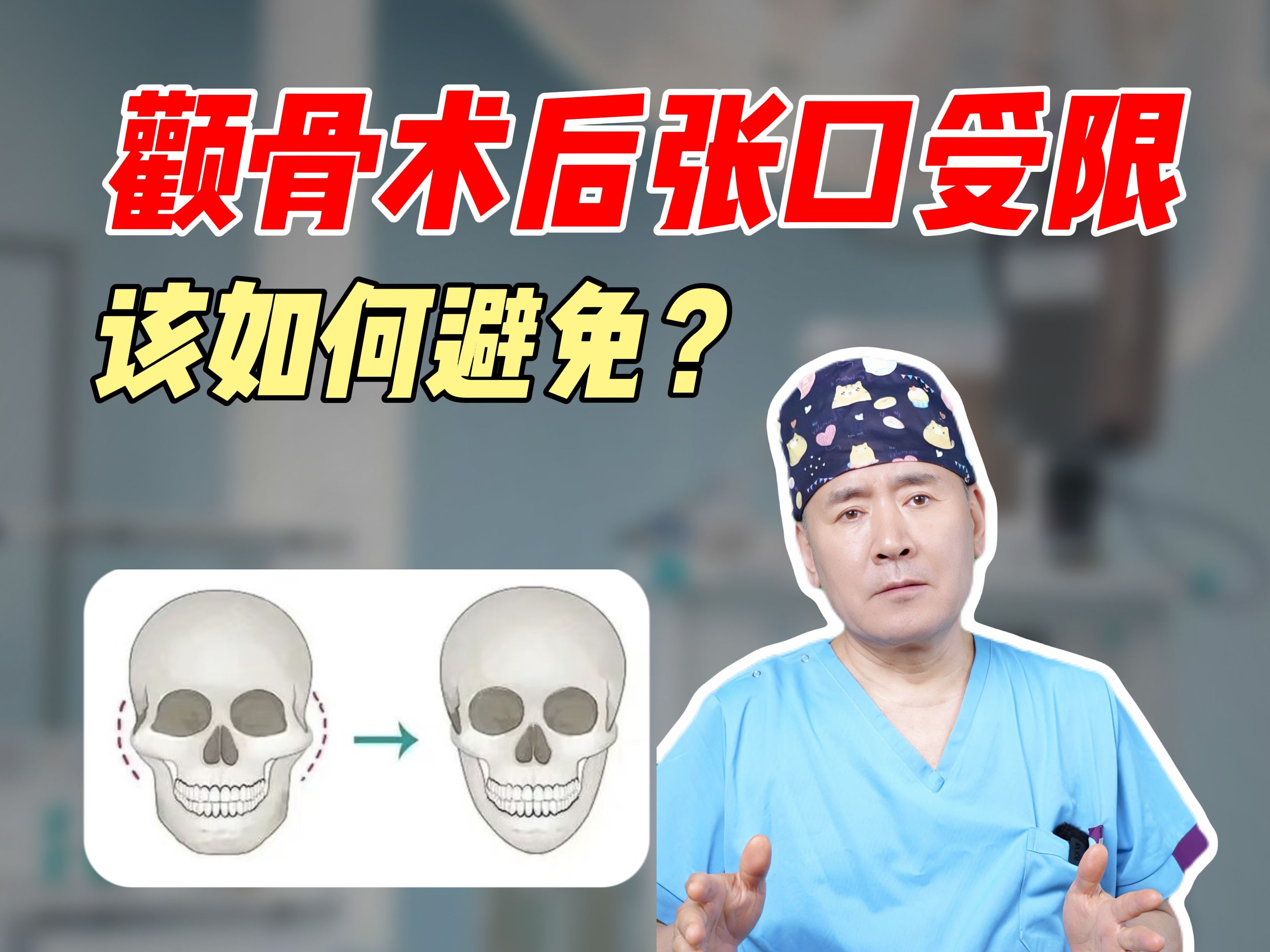 颧骨术后张口受限该如何避免