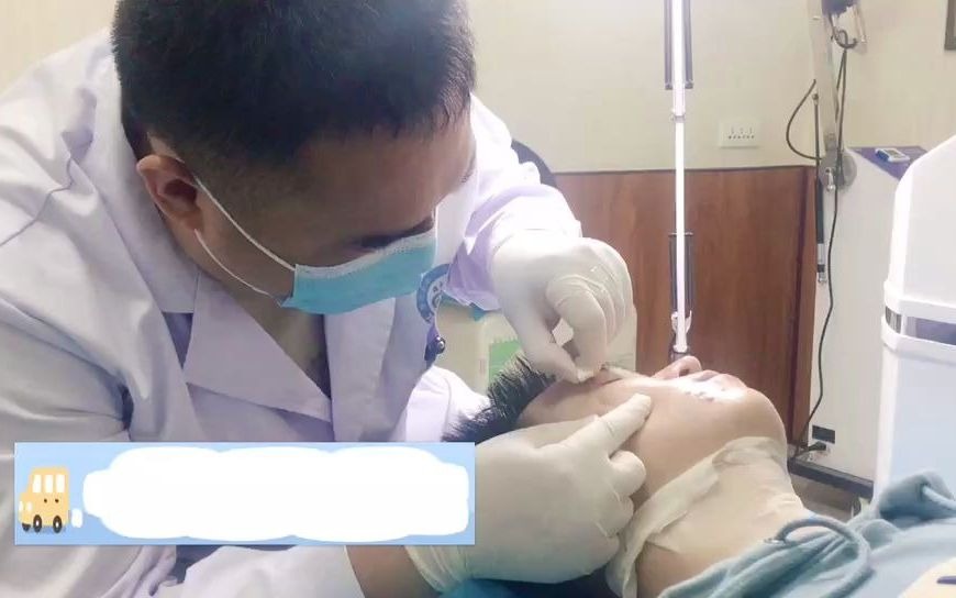 小针刀皮下剥离(联合点阵激光)#许昌德医堂,今天来解决一下我脸上的...