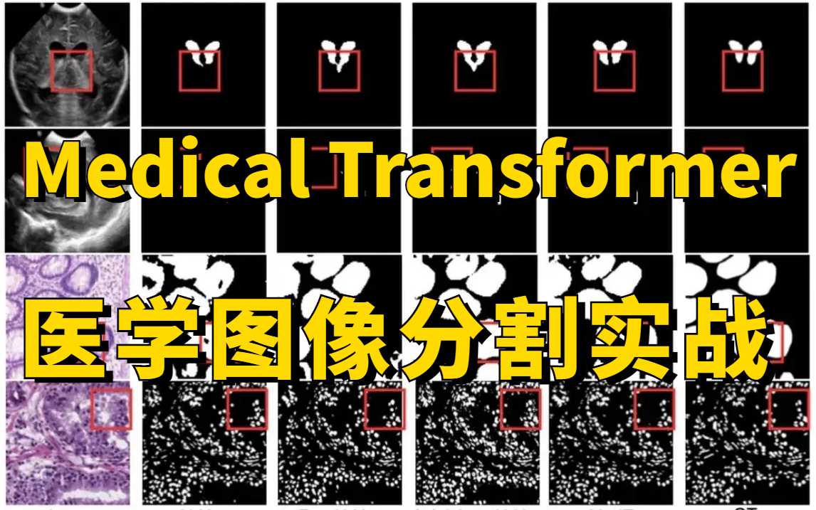 ...跨界CV做分割!基于Medical Transformer的医学图像分割实战教程,...