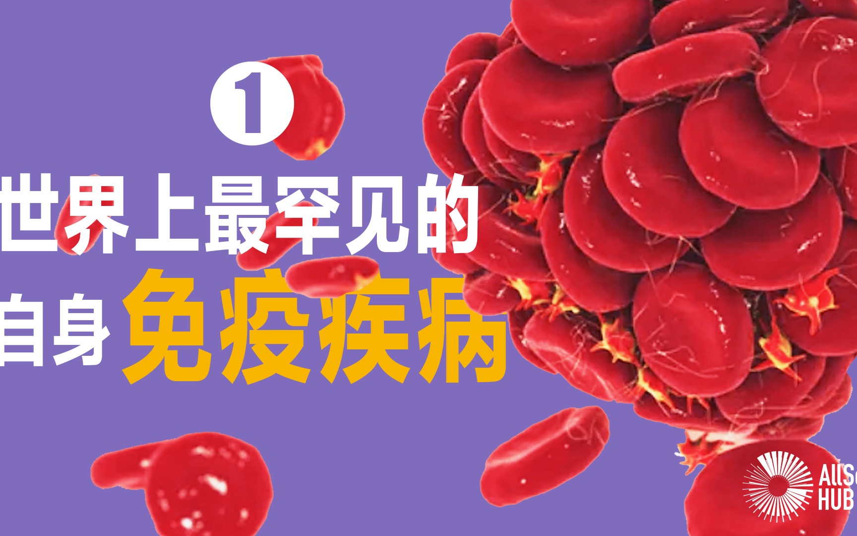 ...皮肤肌炎/吞咽困难/儿童//女性/男性/肌肉/皮疹/肿胀/呼吸困难/吞刀片