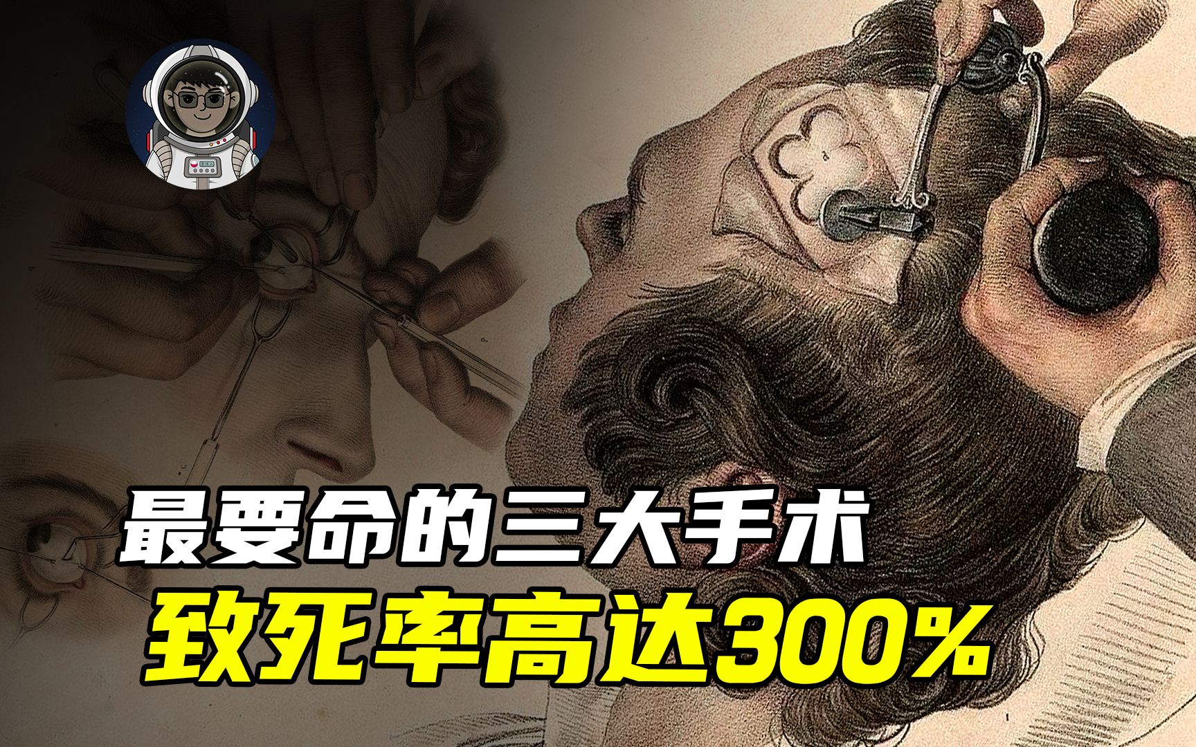 史上最要命的三大手术,致死率竟高达300%,你都听过几个?