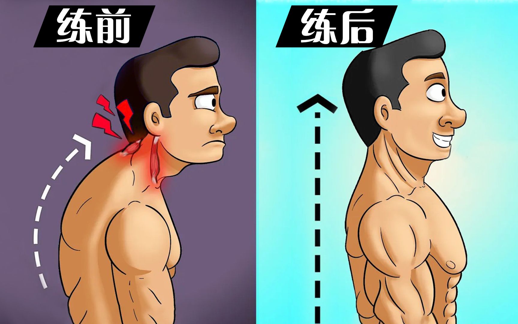 脖子前倾颈部僵硬问题,3分钟教会你颈部前倾如何改善