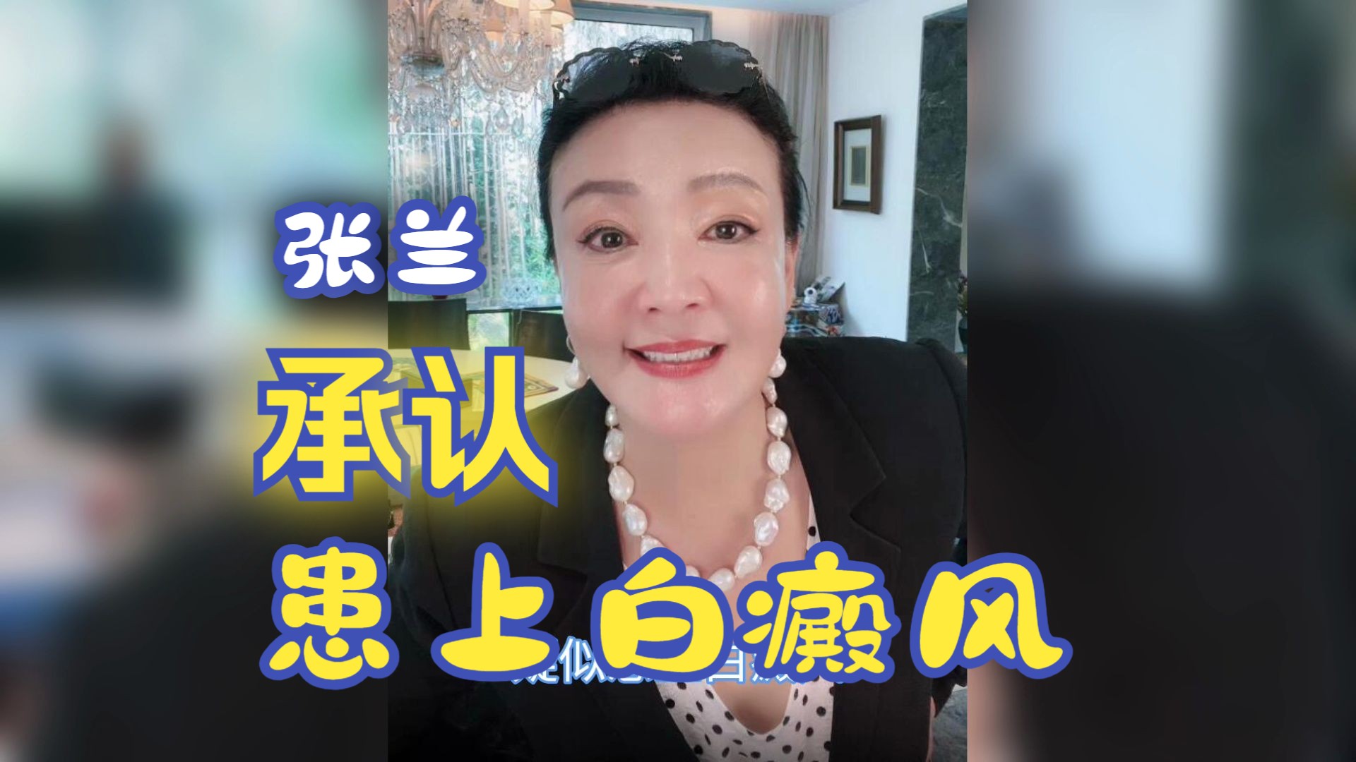 兰州哪家医院治疗白癜风 张兰压力大患上白癜风,“战兰”变“乐观兰”