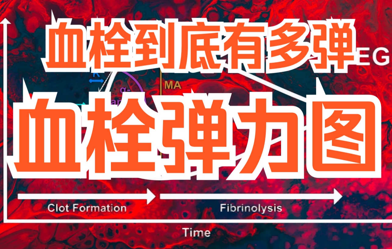 血栓弹力图-血栓你到底有多弹(学完暴虐带教老师系列)
