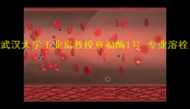 看看血栓形成的动画,预防血栓,刻不容缓!