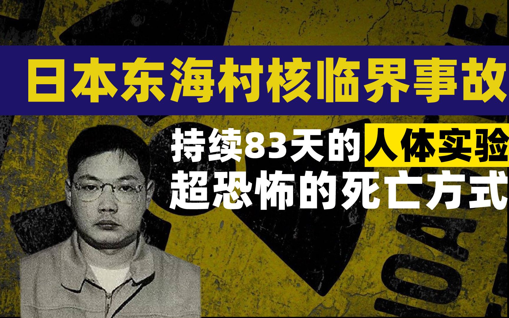 持续83天的人体实验,慢慢体会无比残酷的核辐射死亡