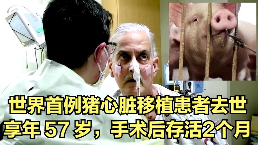 世界首例猪心脏移植患者去世,享年 57 岁,手术后存活2个月