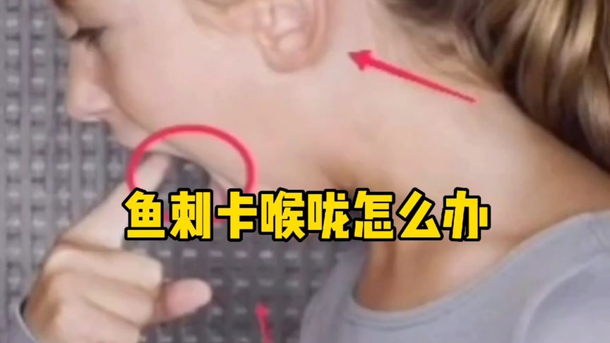鱼刺卡喉咙怎么办?