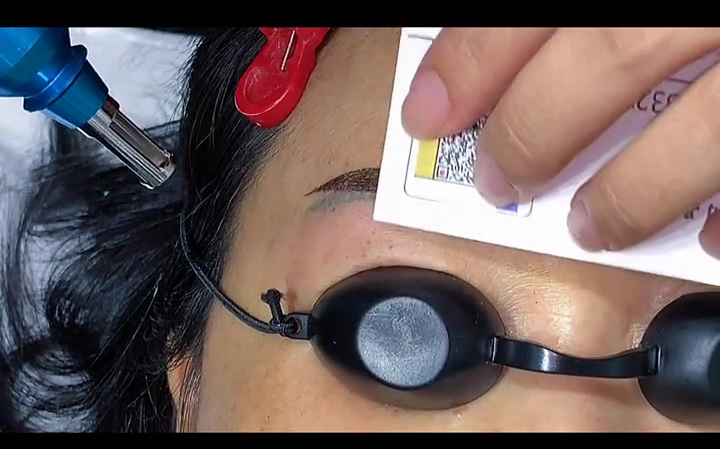 洗眉 激光 美容院