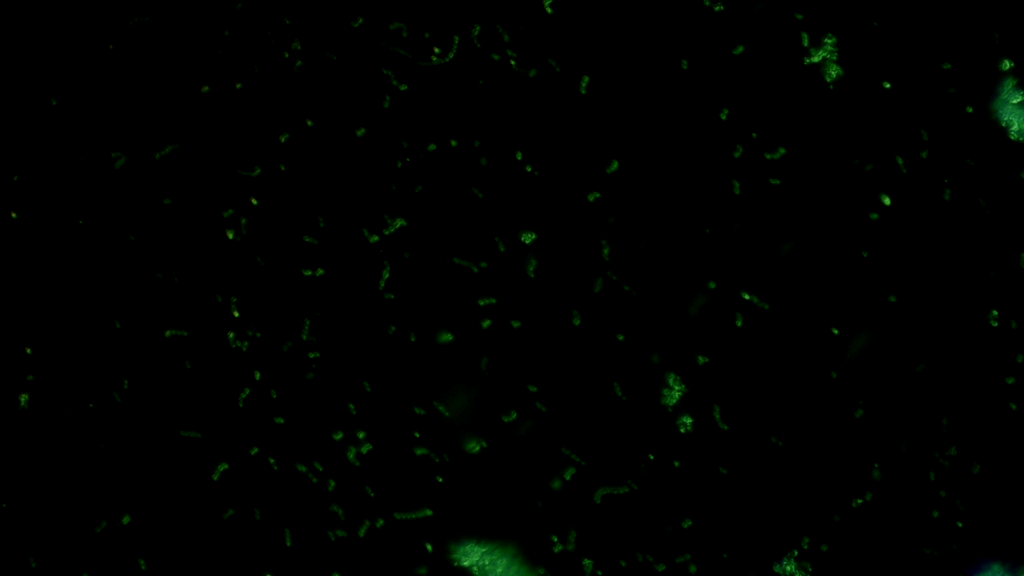 暗视野显微镜下的链球菌