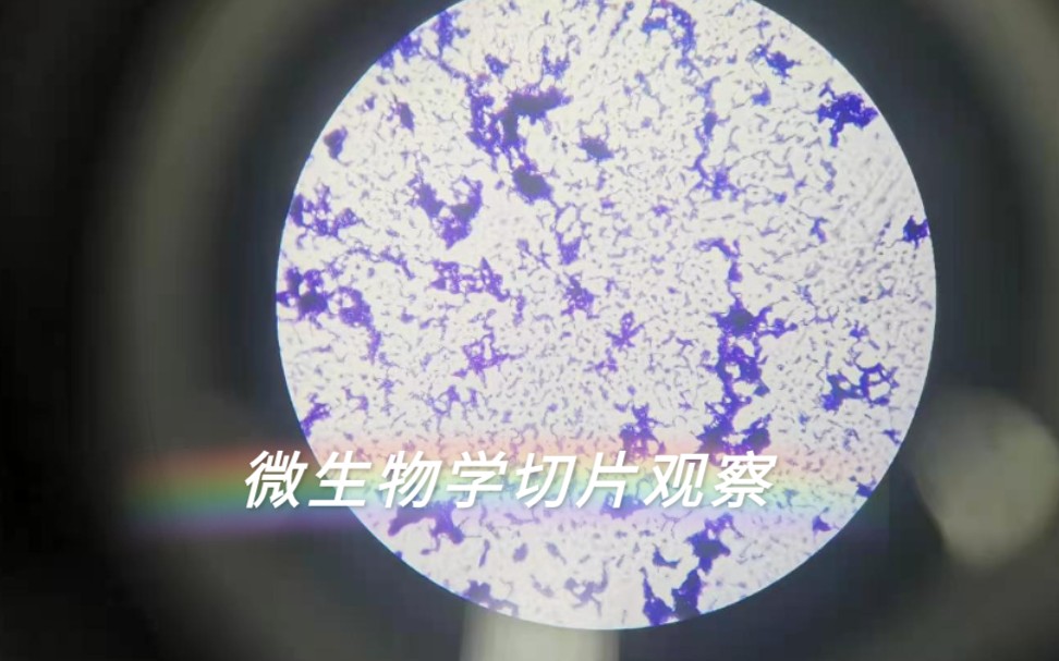 ...微生物学】记录第一次医学微生物学实验 油镜的使用,部分细菌的观察