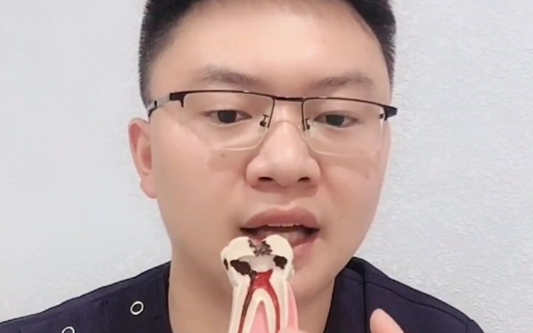 口腔科做根管治疗,就是平时大家理解的牙杀神经