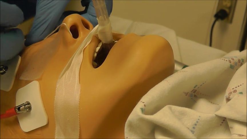 进行全身麻醉的全过程,将手术病人进入麻醉状态的过程