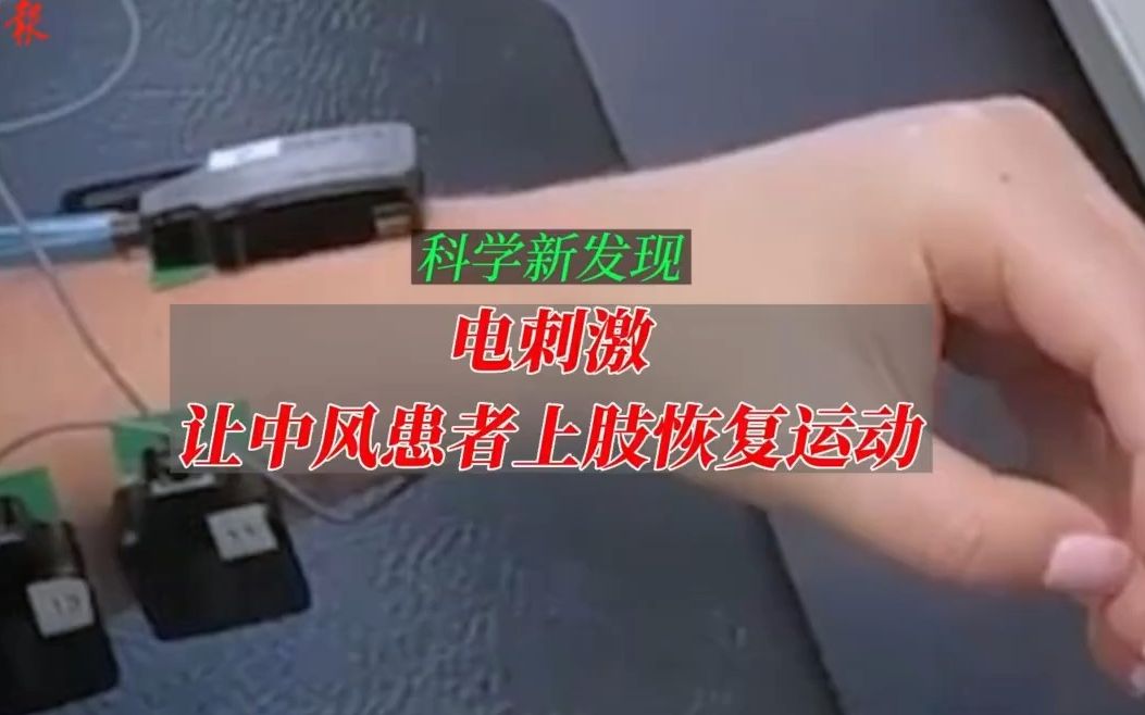 电刺激让中风患者上肢恢复运动