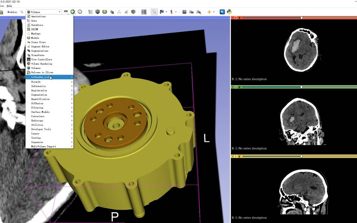利用医学软件3d slicer模拟小米电机CyberGear支持Can通讯支持多路...