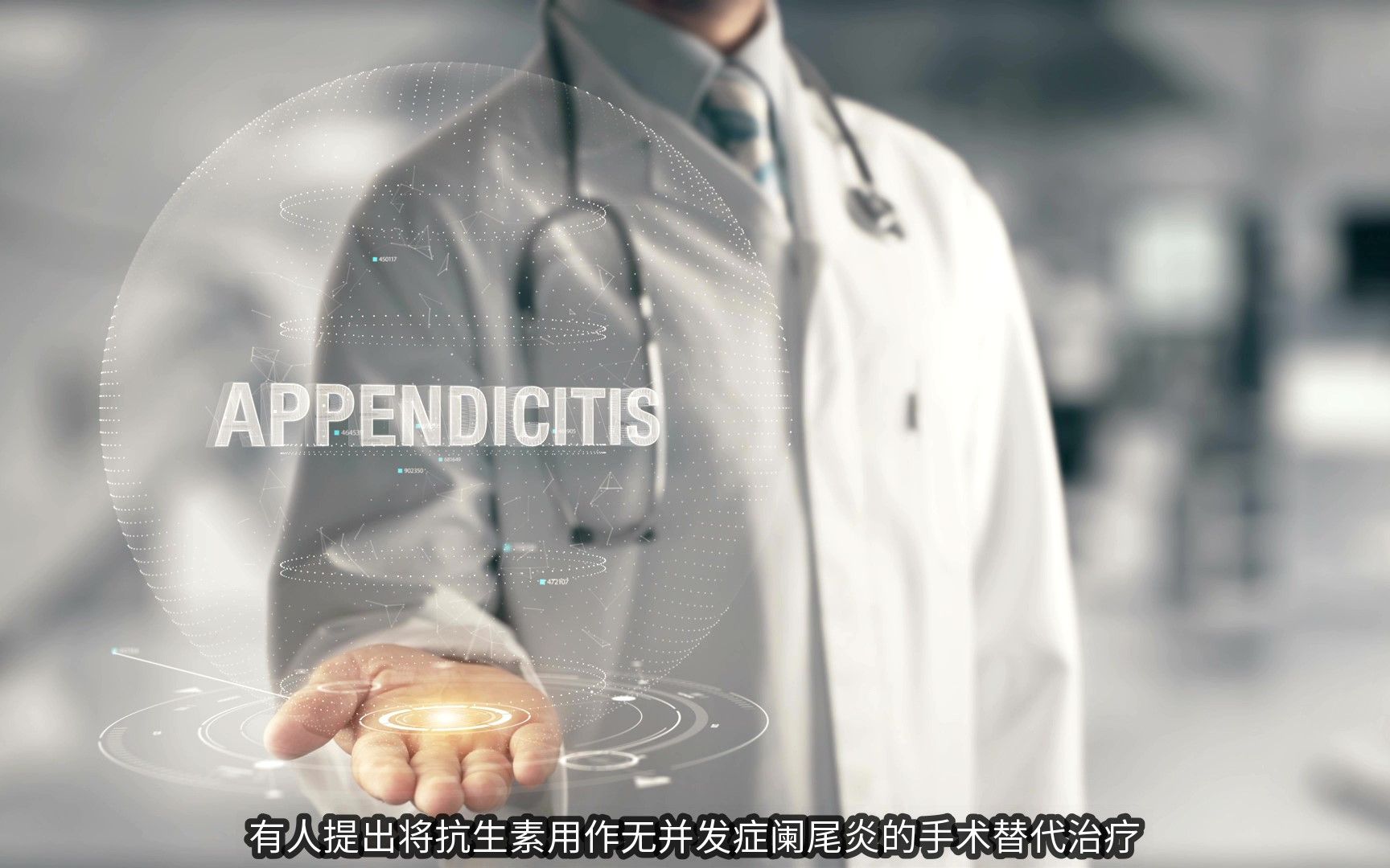 外科新进展|成人阑尾炎初始抗生素治疗后的阑尾切除率?