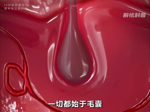 痤疮是怎么长出来的aaa
