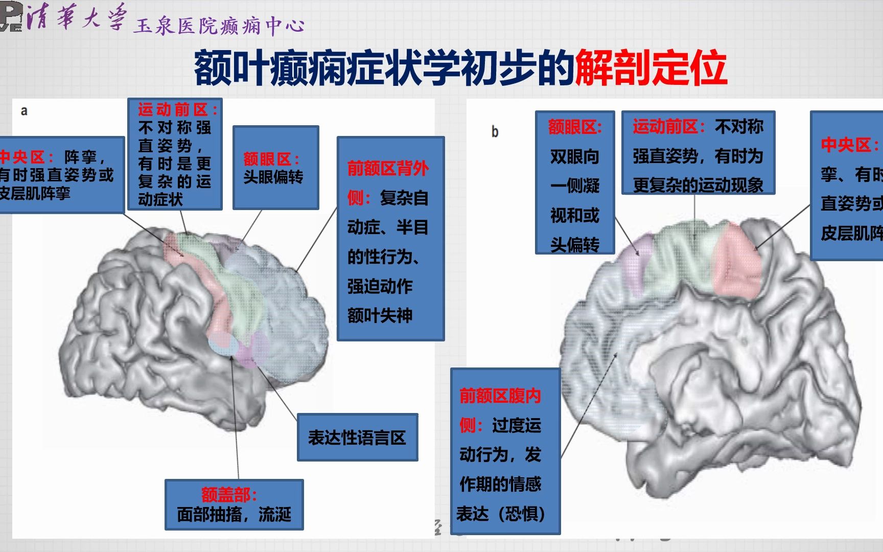 不同额叶皮层癫痫症状学特点