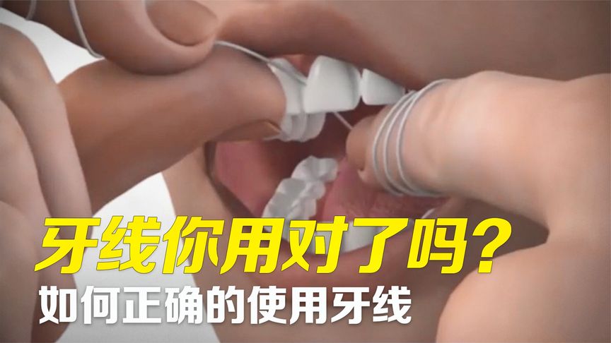 牙线使用不对就会弄巧成拙,那正确使用姿势是怎样的?