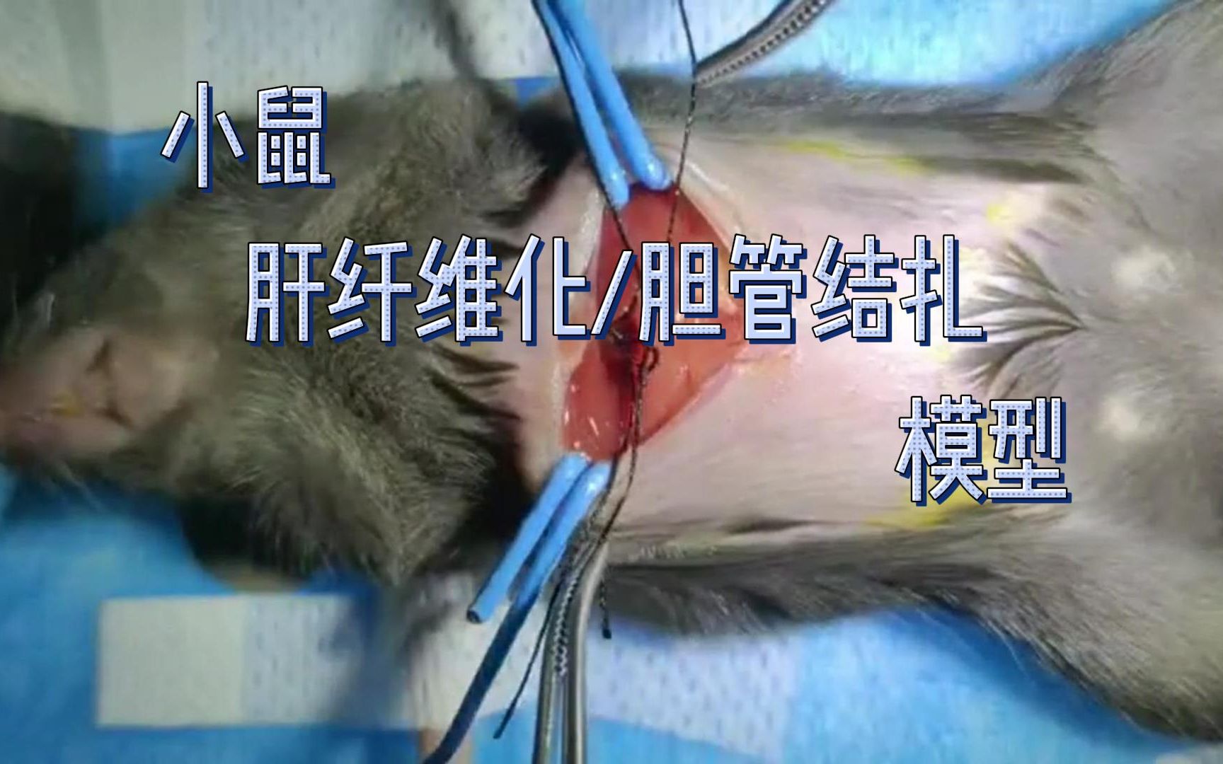 小鼠肝纤维化/胆管结扎疾病模型（教学视频：仅供参考）