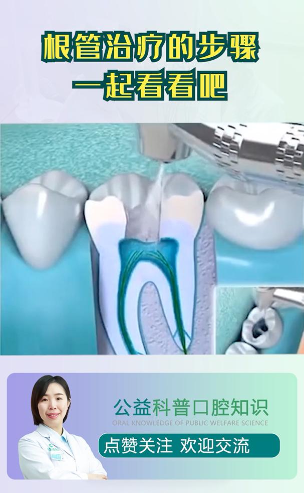 根管治疗的步骤,一起来看看吧