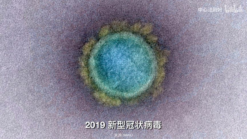新型冠状病毒等各种致命病毒在显微镜下的样子