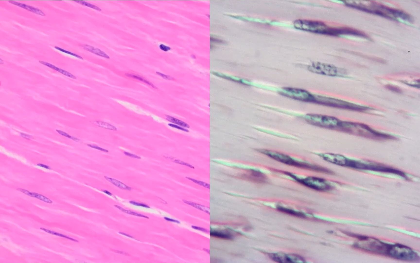 观察比对平滑肌和规则致密结缔组织 Practice Smooth Muscle vs ...