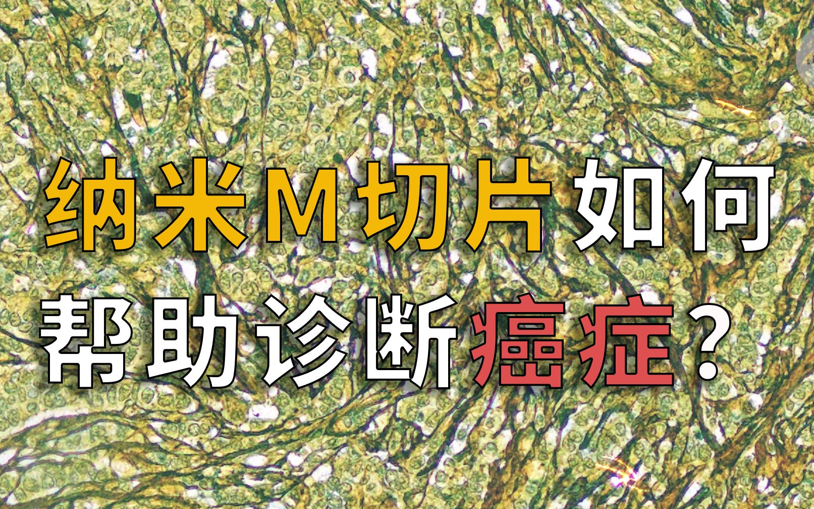 无需染色就能显形癌症细胞的纳米切片