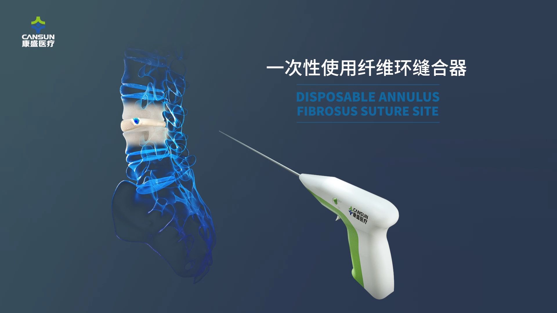 纤维环缝合器